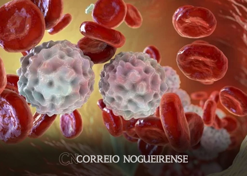 Anvisa autoriza pesquisa em pacientes com leucemia linfoide aguda B ...